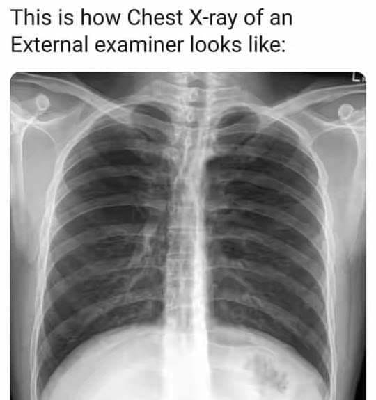The art of homoeopathic treatment based on chest x ray in lung disorders